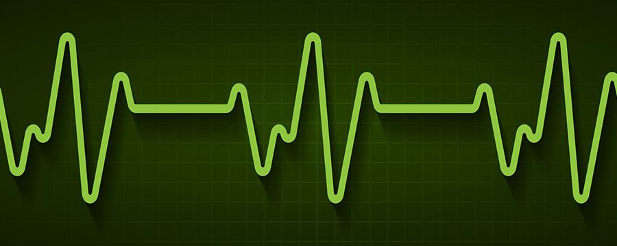 Entender y medir el estrés: cómo el Max Pulse analiza el SNA